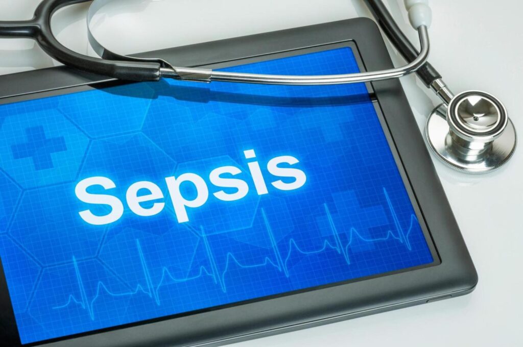 Recognizing Sepsis: Key Signs to Watch for After Hospitalization ...